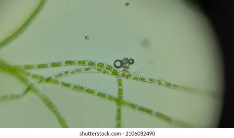 Filamentous Algae Under Transmissive Light Microscope Stock Photo (Edit ...