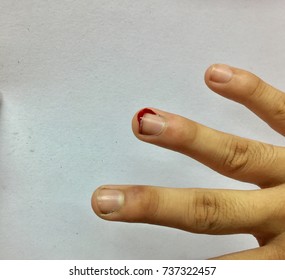 Finger Bleeding Stock Photo 737322520 | Shutterstock