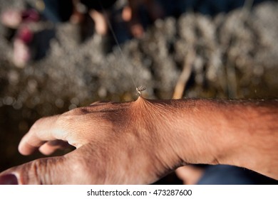 75 Fish hook accident Images, Stock Photos & Vectors | Shutterstock