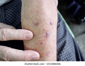 Forearm Images, Stock Photos & Vectors | Shutterstock