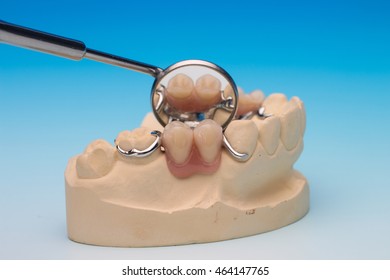 2,513 Dental crown impression Images, Stock Photos & Vectors | Shutterstock