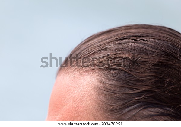 Forehead Men Stock Photo (Edit Now) 203470951