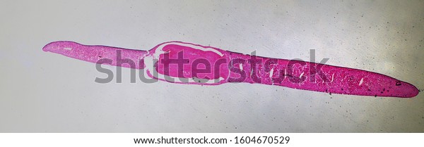 Freeliving Flatworm Turbellaria Under Microscope Foto stock 1604670529 ...