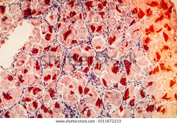 Frog Testicular Tissue Under Microscope Stok Fotoğrafı (Şimdi Düzenle ...