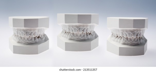Front View Plaster Study Models On Stock Photo 213511357 | Shutterstock
