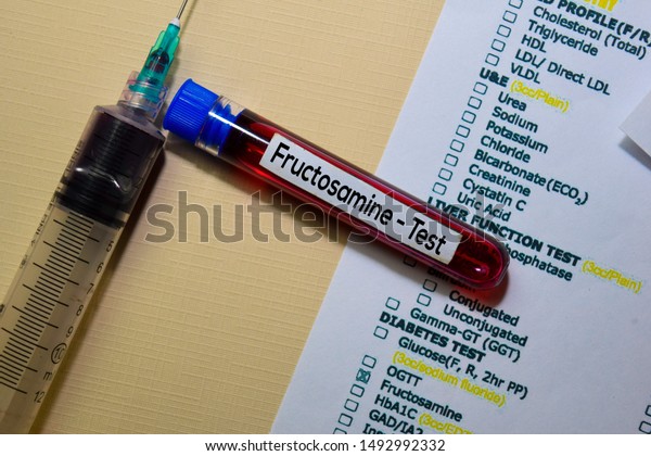 Fructosamine Test Blood Sample Top View Stock Photo 1492992332 ...