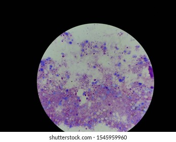 Gram Negative Bacteria Seen Microscope Stock Photo 1545959960 ...