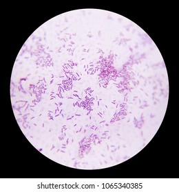 Gram Staining Bacteria Under Microscope Stock Photo 1065340385 ...