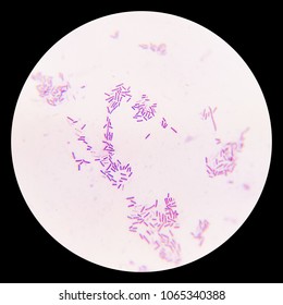 Acetic Acid Bacteria Under Microscope Stock Photo (Edit Now) 617188058