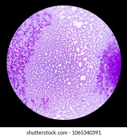 Gram Positive Bacteria Under Light Microscope: Stockfoto (Jetzt ...