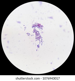 Gram Staining Bacteria Under Microscope Stock Photo 1076943017 ...