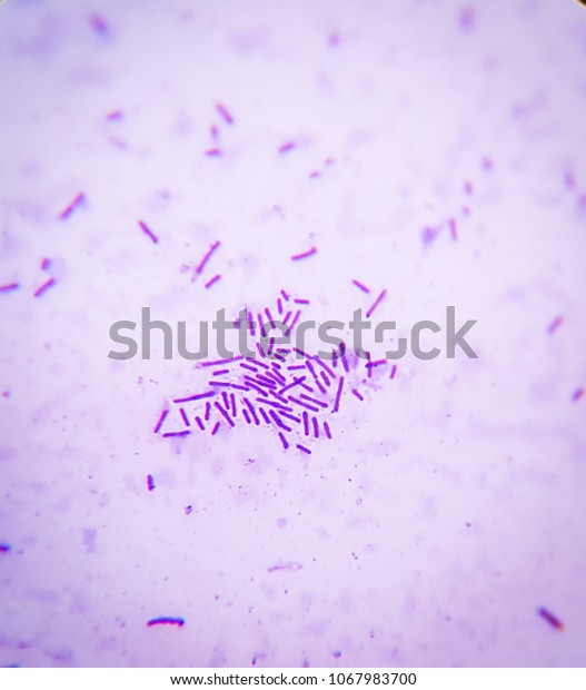 Gram Staining Bacteria Under Microscope Stock Photo (Edit Now) 1067983700