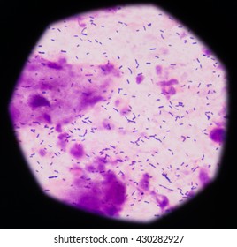 4,716 Grampositiv Bilder, Stockfotos und Vektorgrafiken | Shutterstock