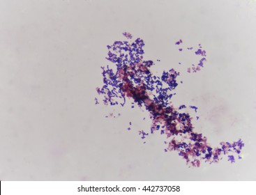 Gram Staining Called Grams Method Method Stock Photo 442737058 ...