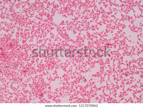Gram Staining Called Grams Method Method Stock Photo (Edit Now) 1217070862