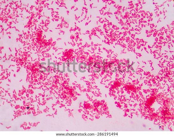 Gram Staining Called Grams Method Method Stock Photo (Edit Now) 286191494