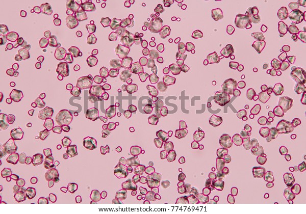 Granules Corn Starchmicroscope20x Stock Photo (Edit Now) 774769471