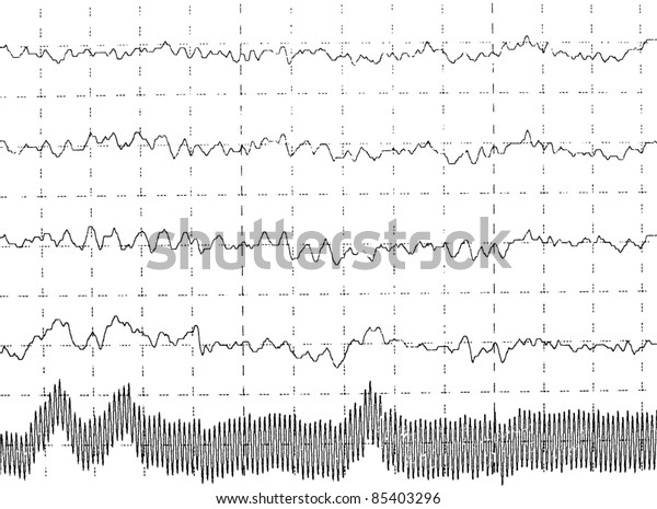 Graph Brain Wave Eeg Isolated On Stock Photo 85403296 | Shutterstock