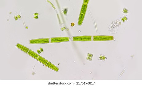 Green Algae Called Netrium Interruptum 400x Stock Photo 2175196817 ...
