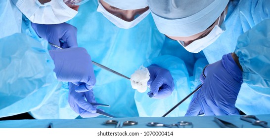 Group Surgeons Work While Operating Hospital Stock Photo 1070000414 ...