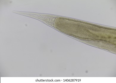 Haemonchus Contortus Under Microscope Stock Photo 1406287961 | Shutterstock
