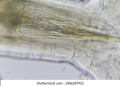 Haemonchus Contortus Under Microscope Stock Photo 1406287961 | Shutterstock