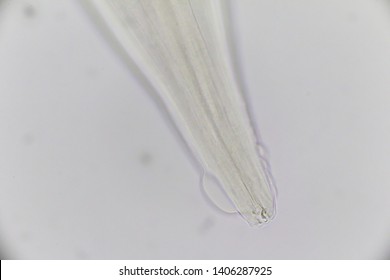 Haemonchus Contortus Under Microscope Stock Photo (Edit Now) 1406287925