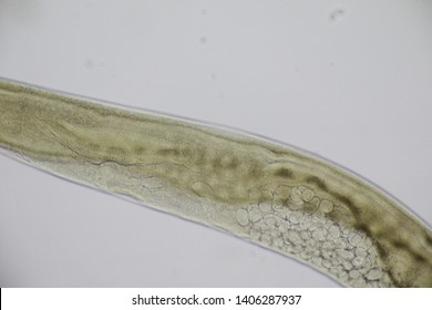 33 Haemonchus Images, Stock Photos & Vectors | Shutterstock