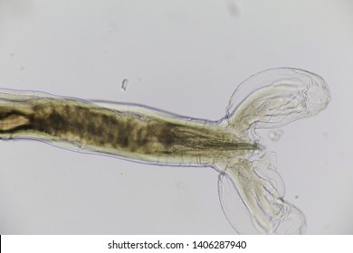 Haemonchus Contortus Under Microscope Stock Photo 1406287940 | Shutterstock