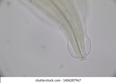 Haemonchus Contortus Under Microscope Foto de stock 1406287958 ...