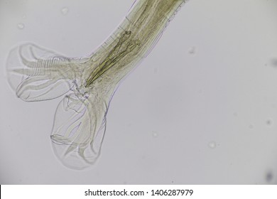 Haemonchus Contortus Under Microscope Stock Photo 1406287979 | Shutterstock