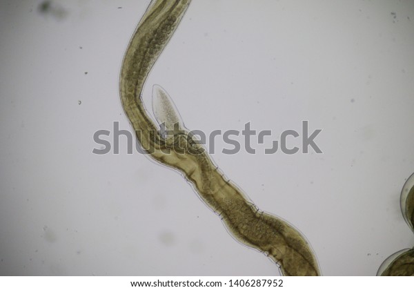 Haemonchus Contortus Under Microscope Stock Photo (Edit Now) 1406287952