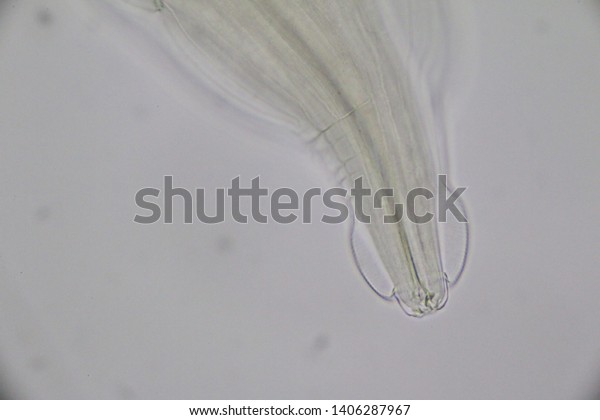 Haemonchus Contortus Under Microscope Stock Photo 1406287967 | Shutterstock