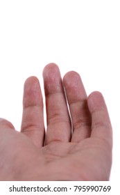 12 Hyperhidrosis wet hand from sweat syndrome Images, Stock Photos ...