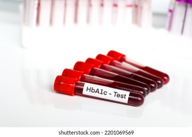 Hba1c Test Blood Blood Samples Be Stock Photo 2201069569 | Shutterstock
