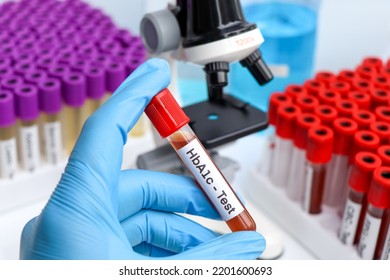 Hba1c Test Blood Blood Samples Be Stock Photo 2201600693 | Shutterstock