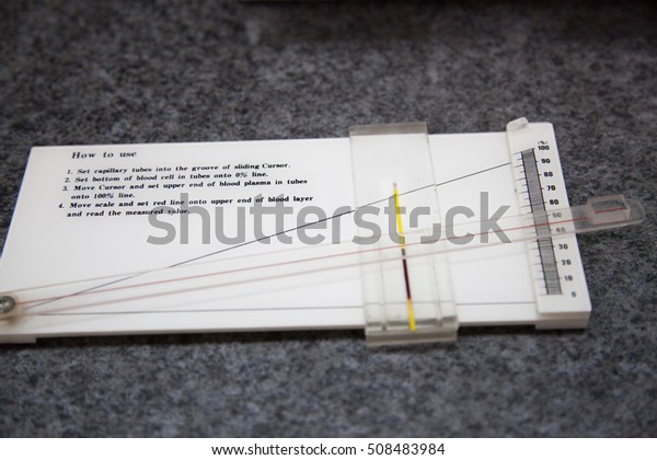 Hematocrit Reader 스톡 사진 508483984 | Shutterstock