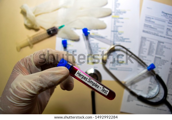 Herpes Simplex Test Blood Sample Top Stock Photo 1492992284 | Shutterstock