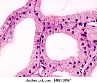 High Magnification Light Microscope Micrograph Showing Stock Photo ...