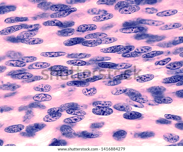High magnification light microscope micrograph showing fibroblasts ...