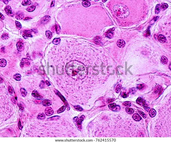 High Magnification Micrograph Pseudounipolar Neuron Dorsal Stock Photo ...