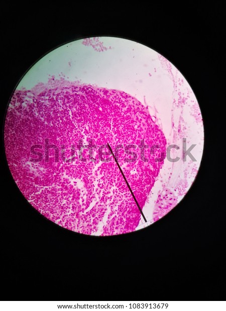 Histological Slide Tissue Sample Stock Photo (Edit Now) 1083913679