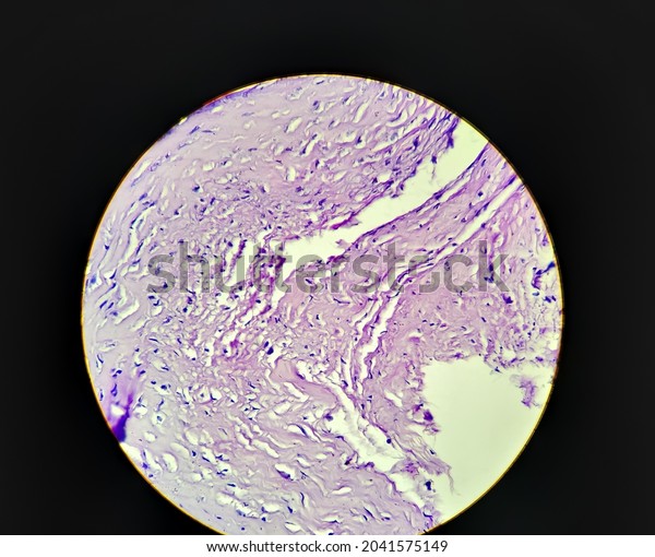 Histological Slide Tissue Sample Close Microscopic Stock Photo ...