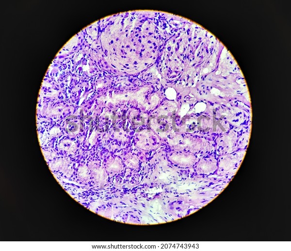 Histological Slide Tissue Sample Close Microscopic Stock Photo ...