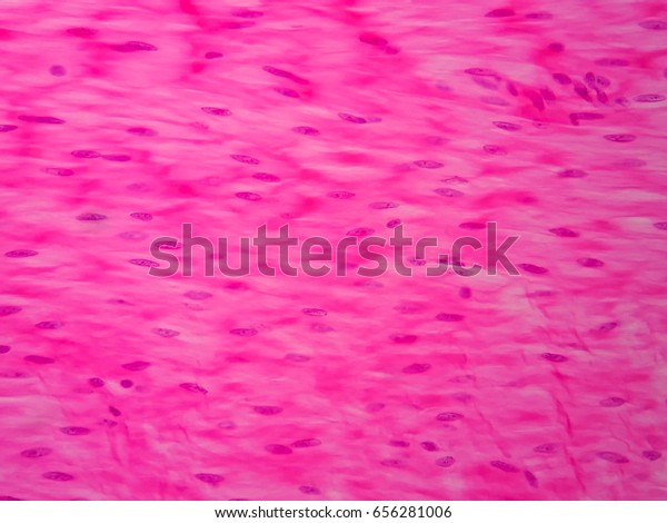 Histology Human Smooth Muscle Under Microscope Stock Photo (Edit Now ... Histology Human Smooth Muscle Under Microscope Stock Photo (Edit Now ...