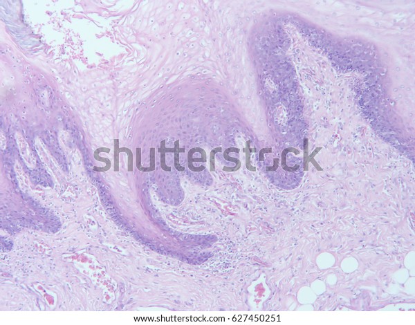 Histology Human Tissue Microscope View Stock Photo 627450251 | Shutterstock