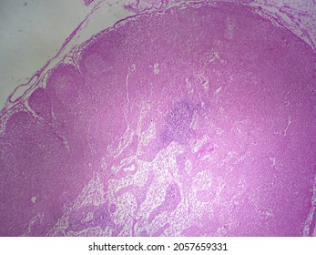 Histology Microscope Image White Fibrocartilage 400x Stock Photo ...