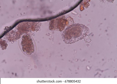 Hookworm Images, Stock Photos & Vectors | Shutterstock