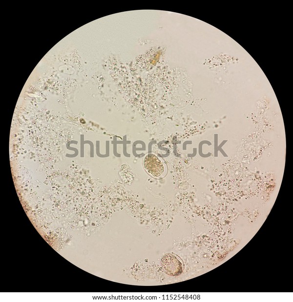Hookworm Egg Under Microscopic Field Srongyloides Stock Photo (Edit Now ...