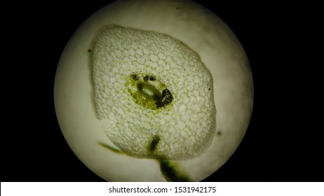 Vorticella Microstoma Green Algae Under Microscopic库存照片2140774957 ...